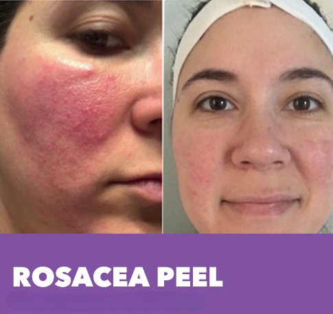 Rhonda Allison - New Face Vienna