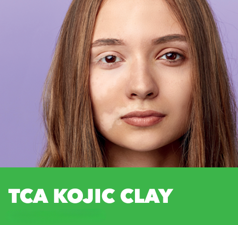 Rhonda Allison - New Face Vienna